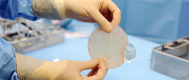 Prothèses PIP : la Ligue contre le cancer va porter plainte - Le Point