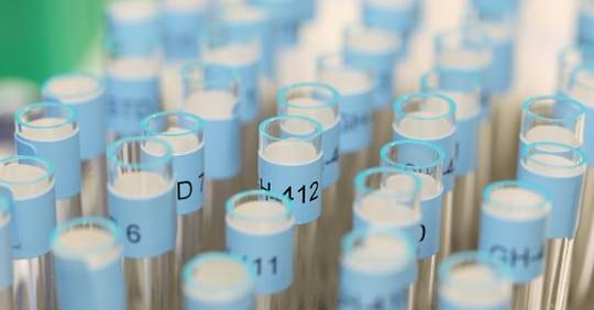 Lutte antidopage: qui est contrôlé, comment et pourquoi