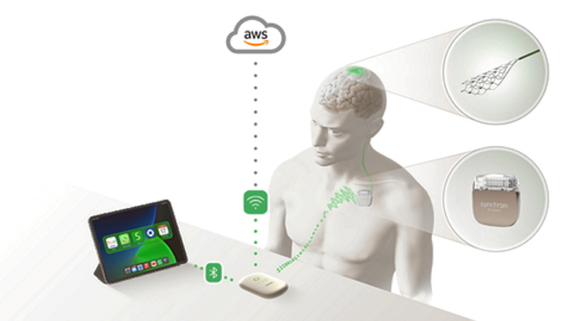 Implants cérébraux : cette société connecte les cerveaux à l’Apple ...